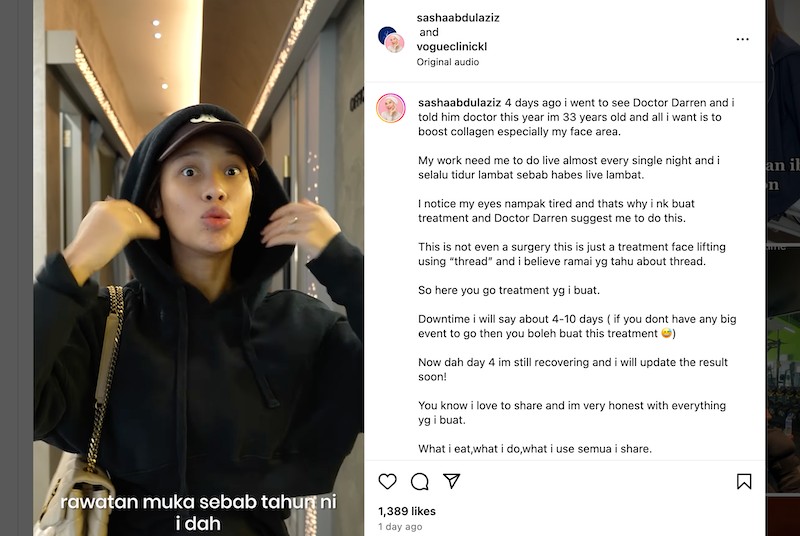 Dikecam buat rawatan tanam benang pada wajah, Sasha Abdul Aziz pertahan ...