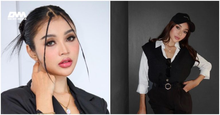 Mahu wajah sempurna, Scha Elinnea akui buat pembedahan muka